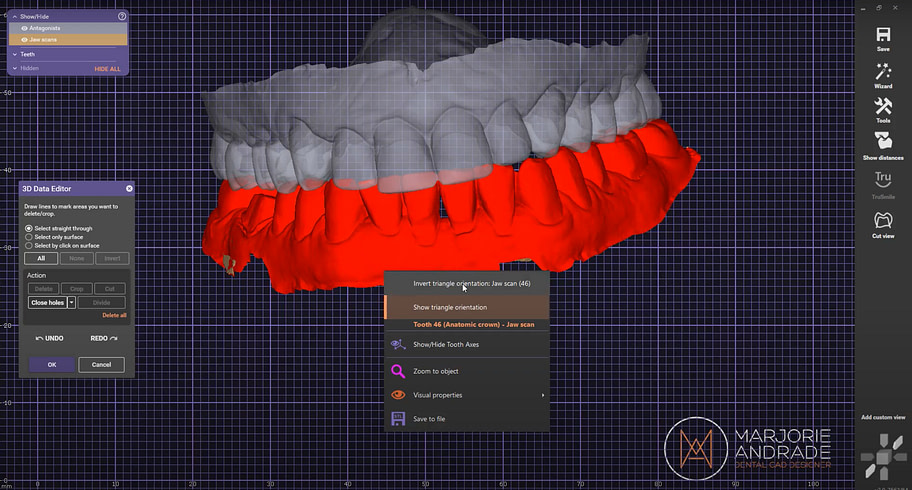 What is exocad? A Comprehensive Overview - Institute of Digital Dentistry