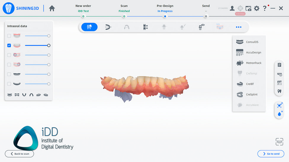 Aoralscan 3 Wireless Intraoral Scanner Review