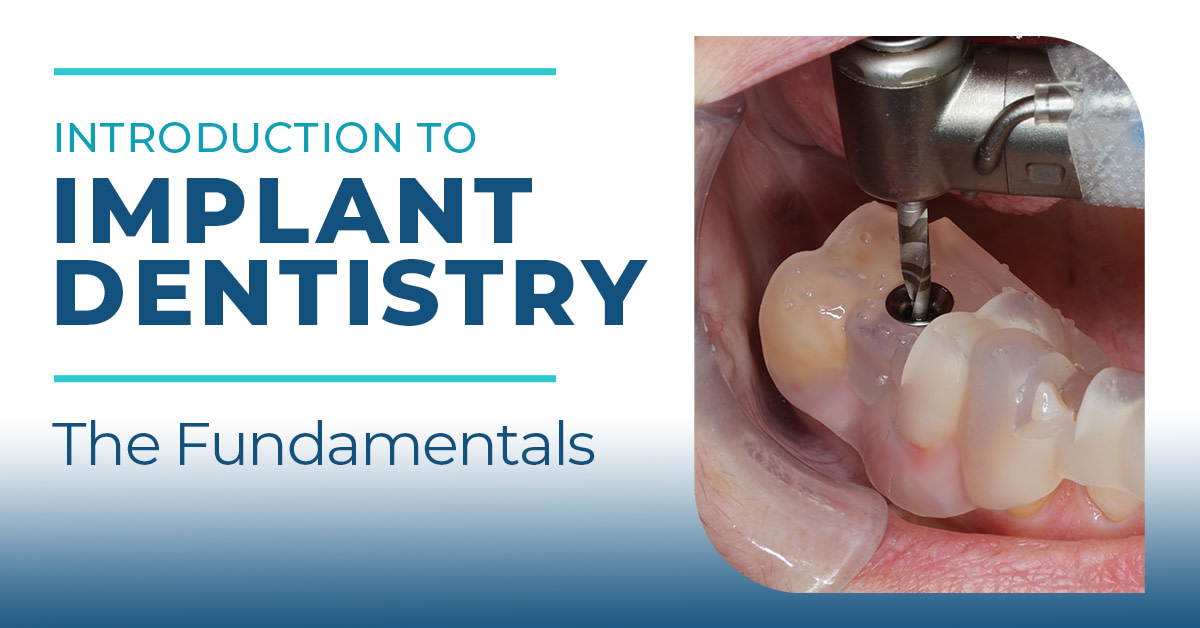 Introduction To Implant Dentistry - The Fundamentals | Institute Of ...
