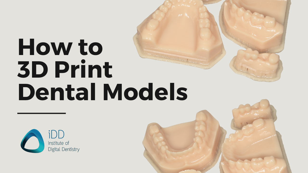 How to 3D Print Dental Models with iDD