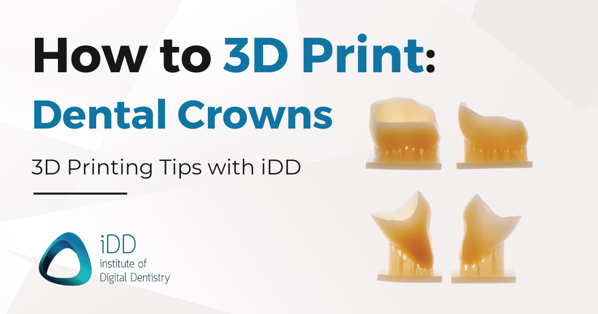 How to 3D Print Dental Crowns with iDD - Institute of Digital Dentistry