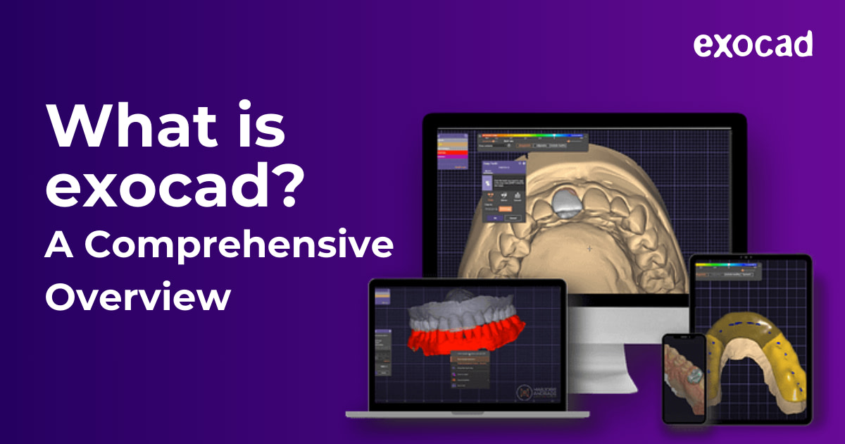 What is exocad? A Comprehensive Overview - Institute of Digital Dentistry