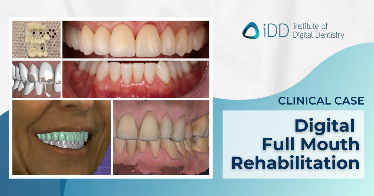 A Digital Approach to a Full Mouth Rehabilitation - Institute of ...