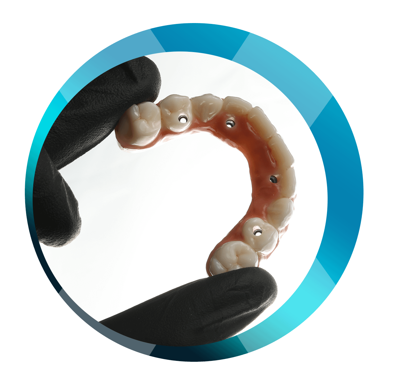 Ultimate All-on-X Implant online course by Dr Mark Bishara