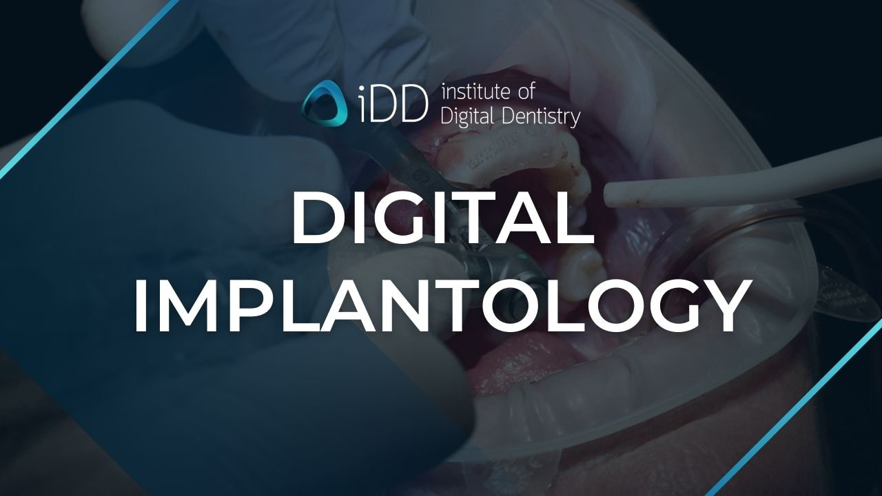Learn Digital Implantology | Institute Of Digital Dentistry