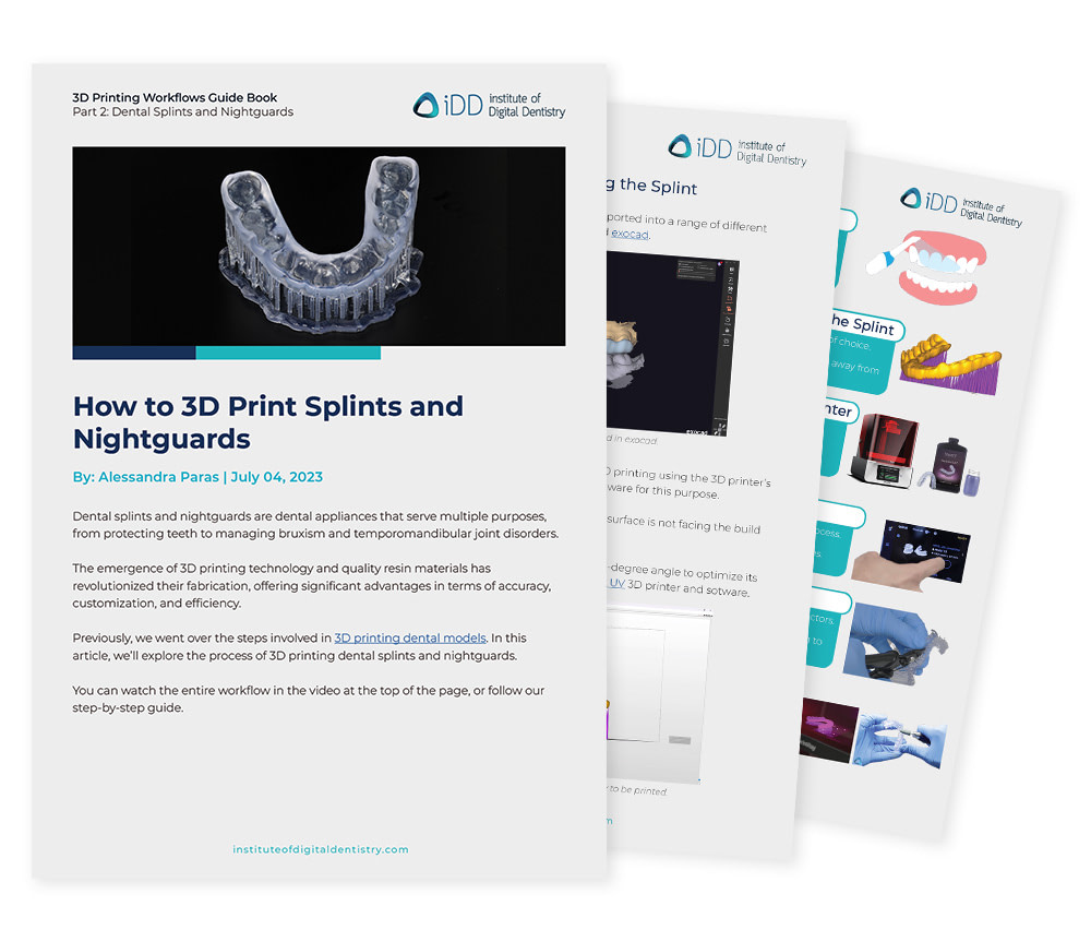 Dental Splints & Nightguards Workflow Free PDF Download