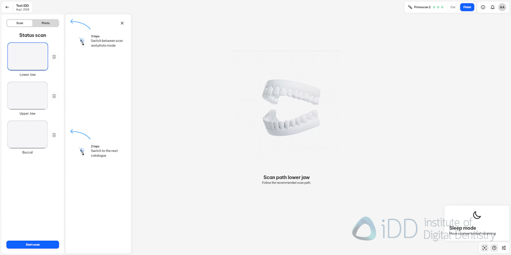 Primescan 2 Intraoral Scanner Review by iDD