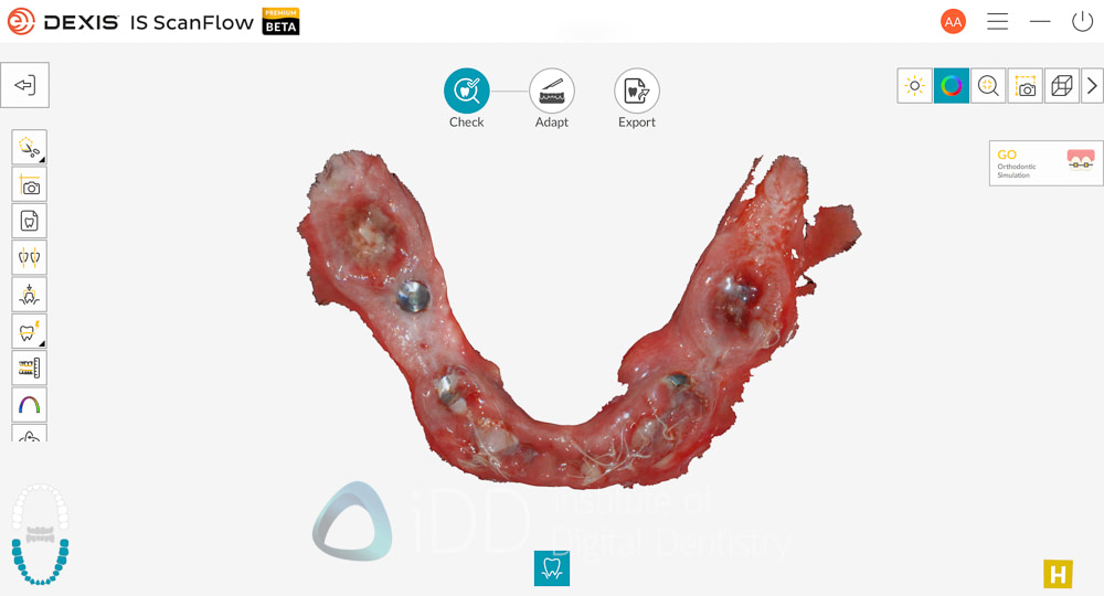 DEXIS IS 3800 Wireless Intraoral Scanner Review by iDD