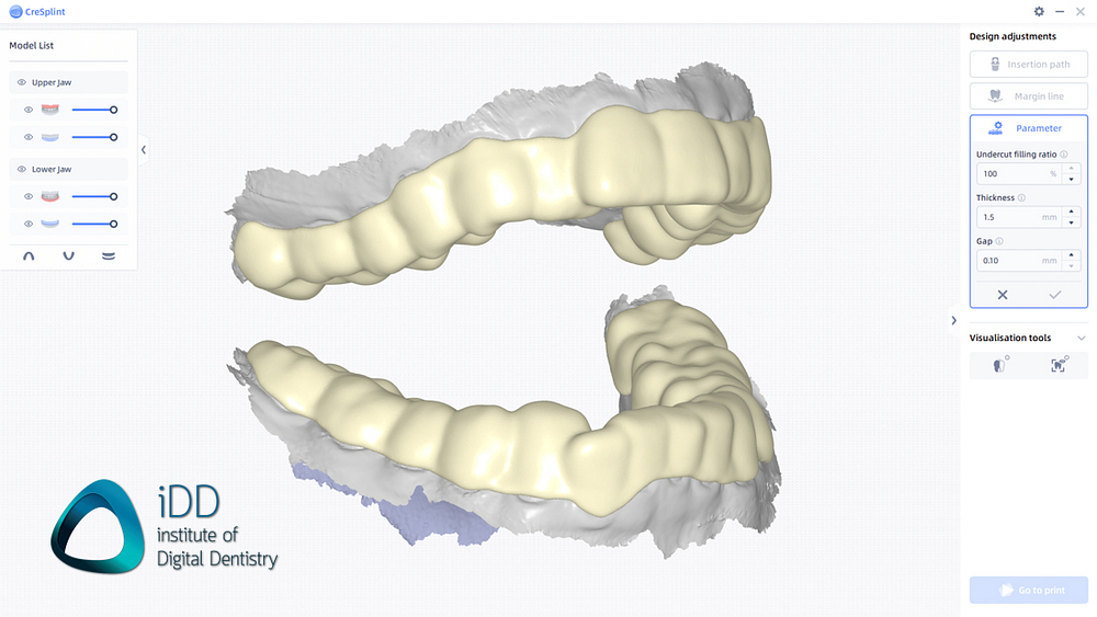 Shining 3D Aoralscan Elite Review by iDD