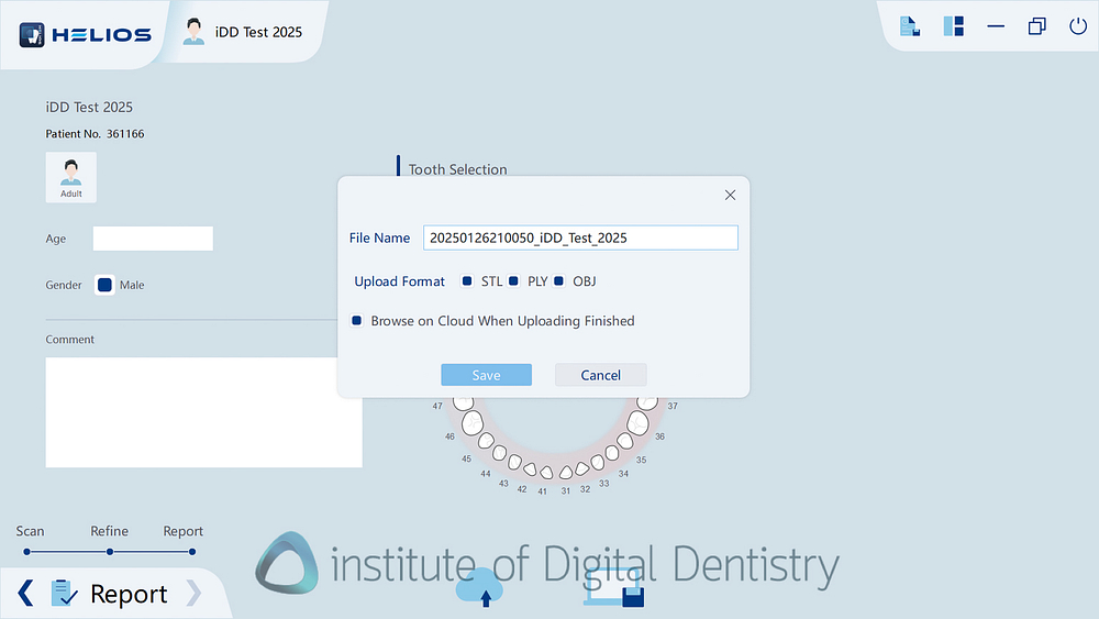 Helios 500 Intraoral Scanner Review