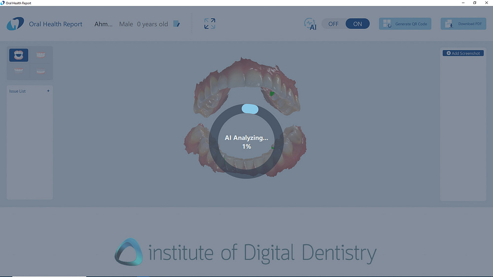 Helios 500 Intraoral Scanner Review