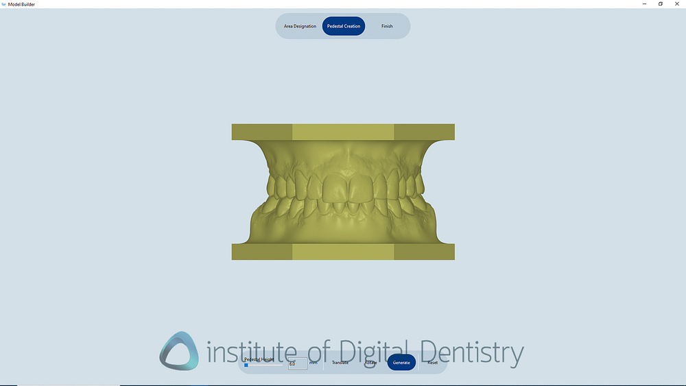 Helios 500 Intraoral Scanner Review