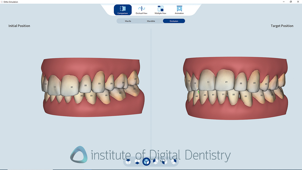 Helios 500 Intraoral Scanner Review
