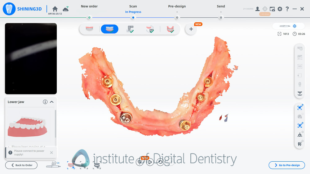 Shining 3D Aoralscan Elite Review | Institute of Digital Dentistry