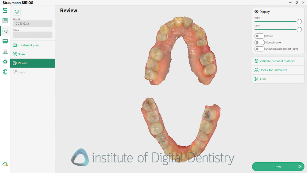 Straumann SIRIOS Intraoral Scanner Review by iDD