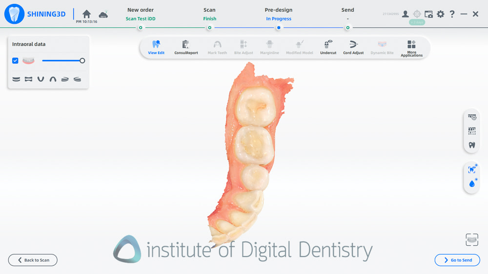 Shining 3D Aoralscan Elite Review | Institute of Digital Dentistry