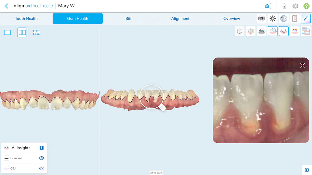 iTero Expands Software Platform - from Scanner to Solutions