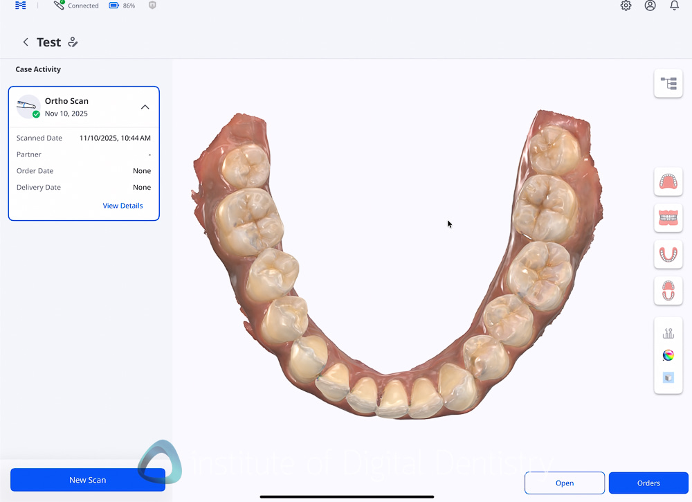 Medit i900 Mobility Intraoral Scanner Review by iDD