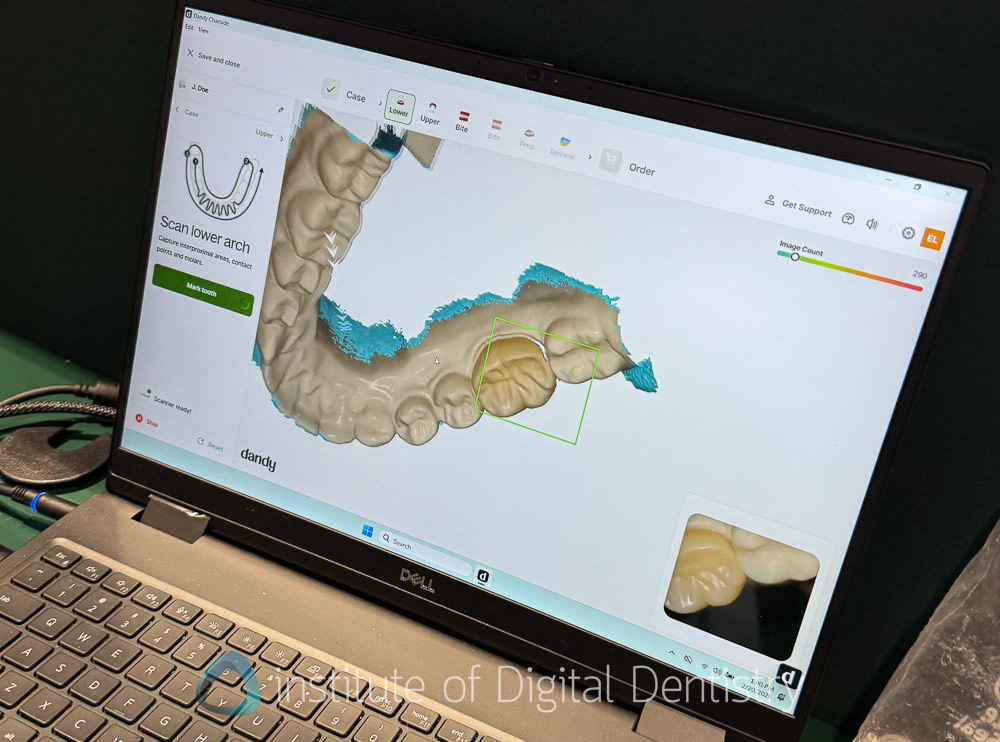 Dandy - The Digital Lab Giving Away Free Dandy Vision Scanners