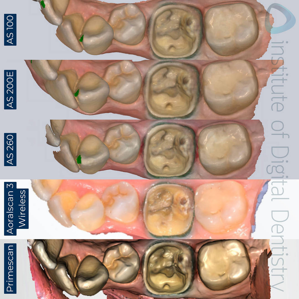 iDD Compares Alliedstar's Intraoral Scanners