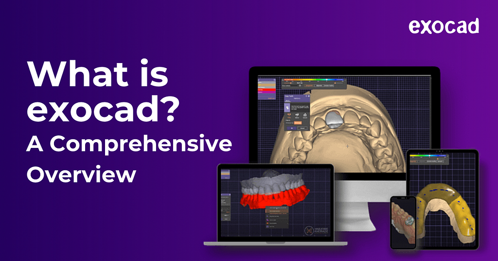 What is exocad? A Comprehensive Overview - Institute of Digital Dentistry