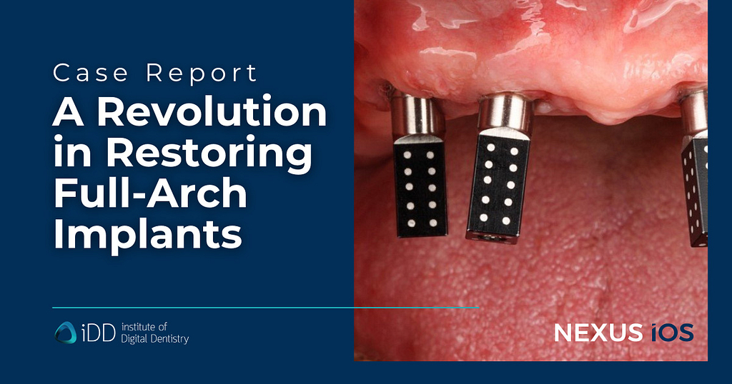 The Nexus IOS Workflow - Restoring Full Arch Implants