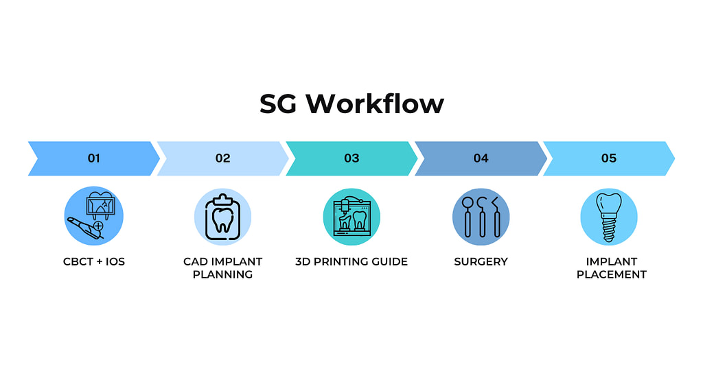 X-Guide Review - Dynamic Navigation for Implantology - iDD