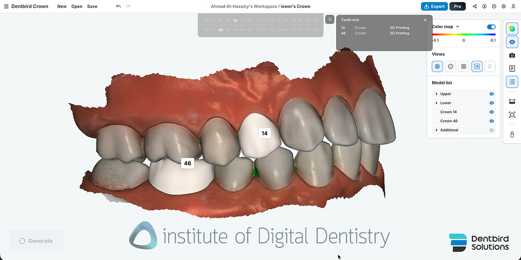 CAD Software in Dentistry - How Everything is Going to the Cloud