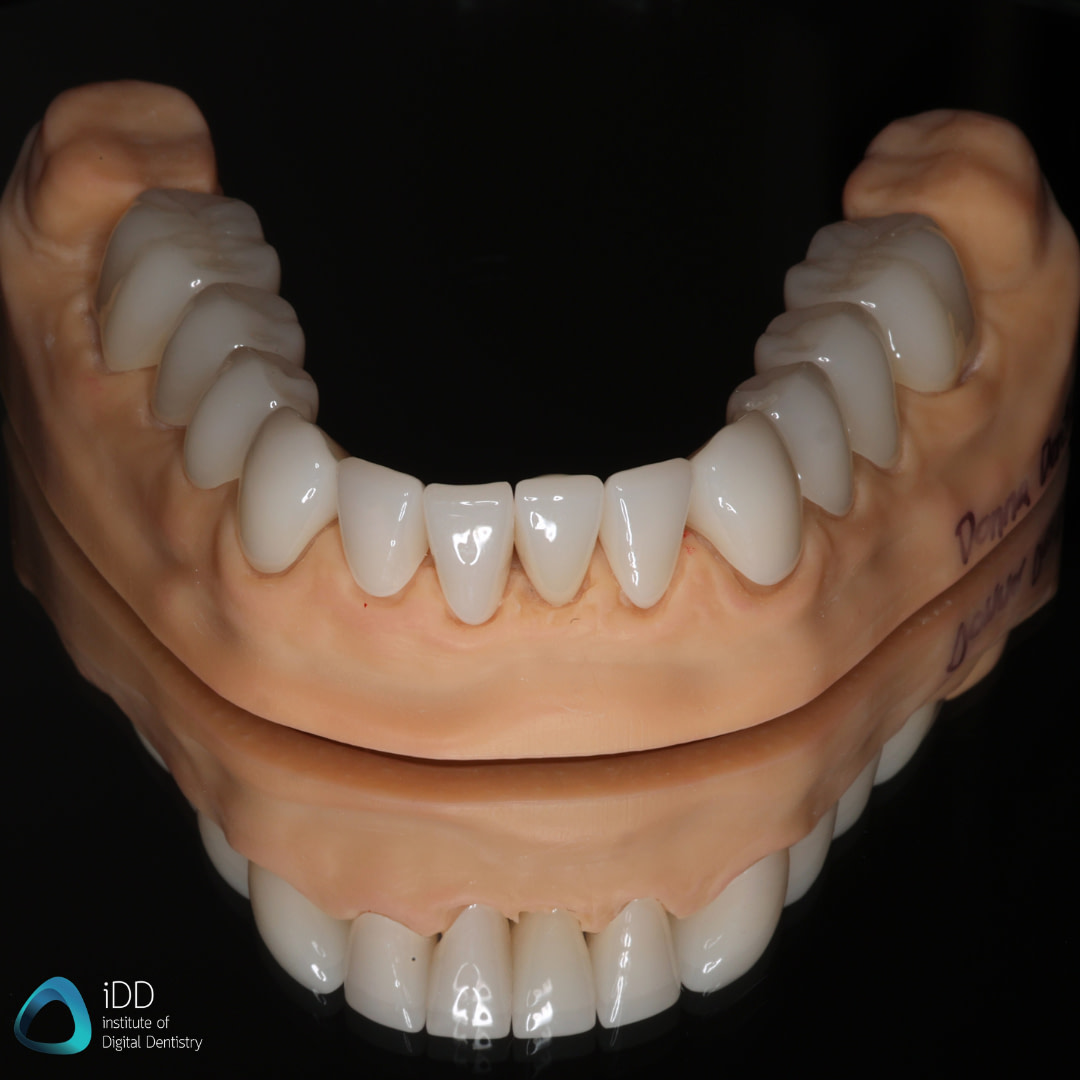 A Digital Approach to a Full Mouth Rehabilitation - Institute of ...