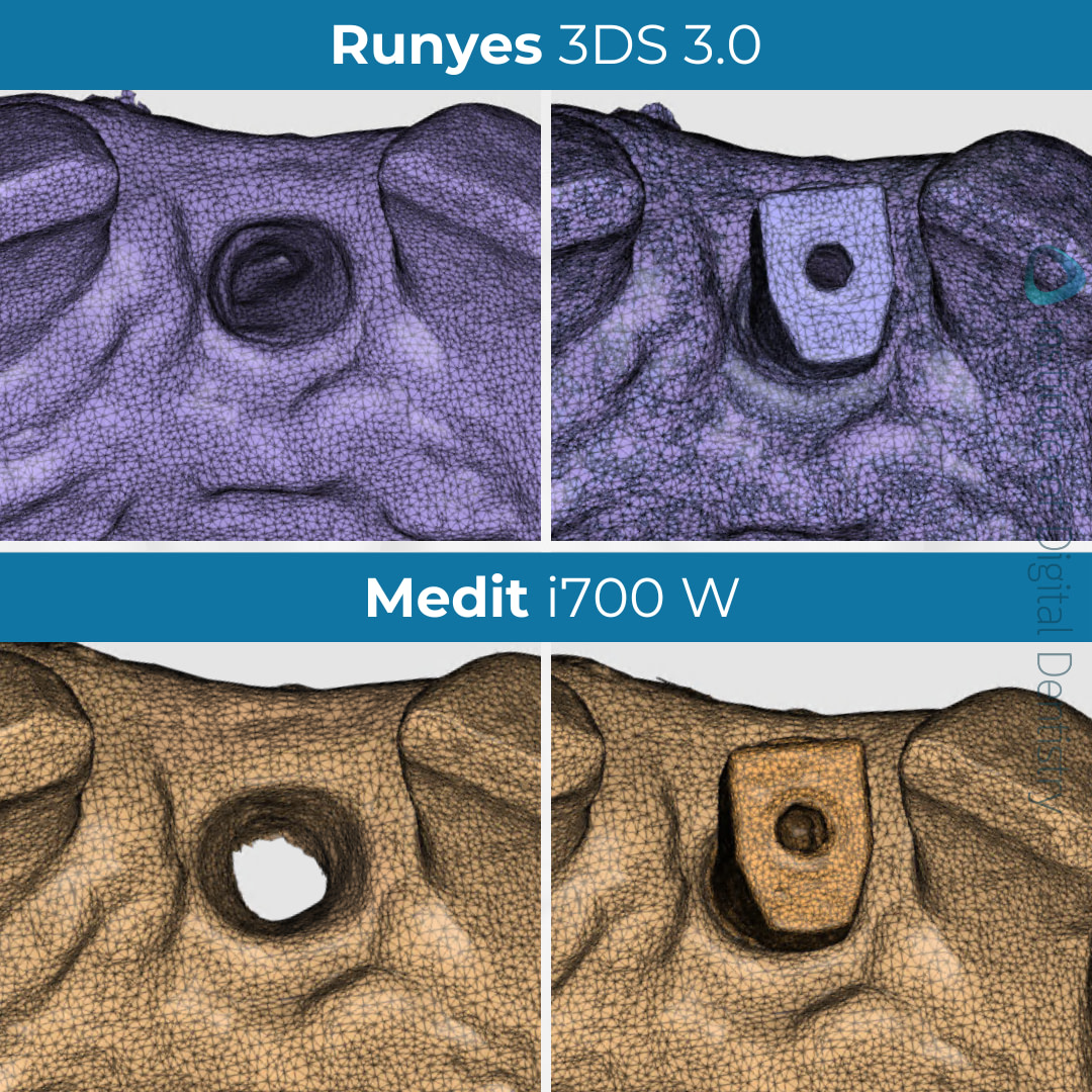iDD Compares: Runyes 3DS 3.0 vs. Medit i700