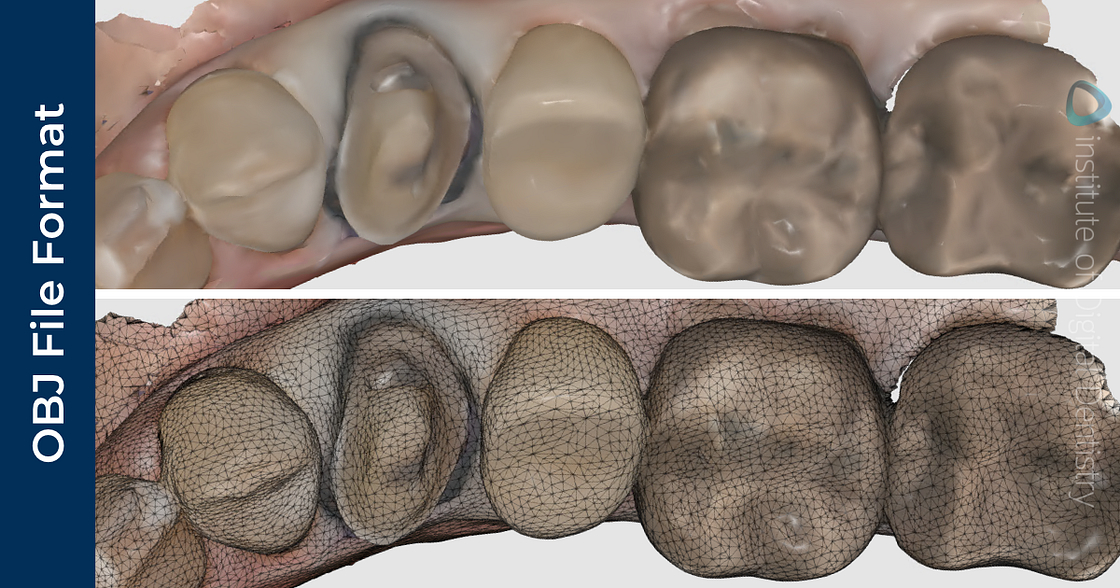 Understanding STL, PLY, and OBJ Files in Digital Dentistry - Institute of Digital Dentistry