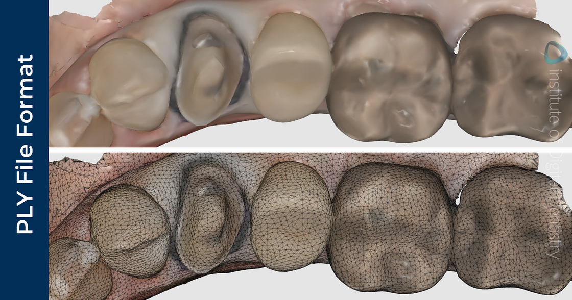 Understanding STL, PLY, and OBJ Files in Digital Dentistry - Institute of Digital Dentistry