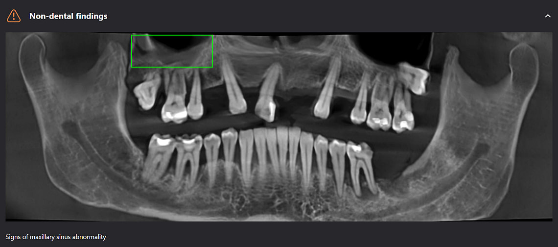 Diagnocat Review - AI Diagnostics of 2D and 3D X-rays in Dentistry
