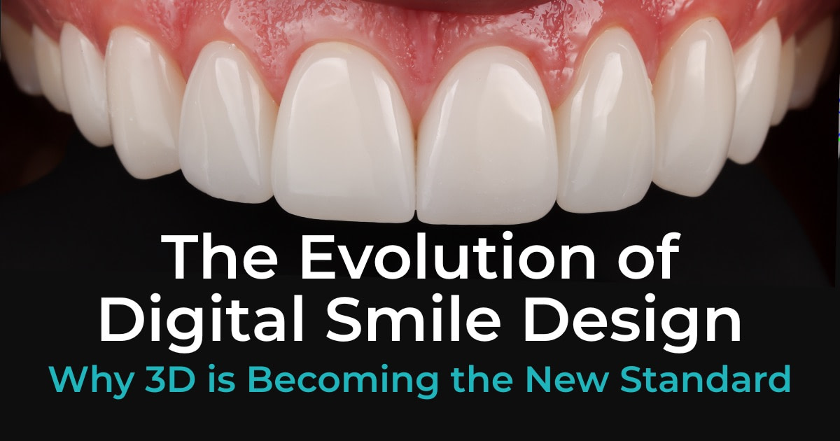 The Evolution of Digital Smile Design: Why 3D is Becoming the New ...
