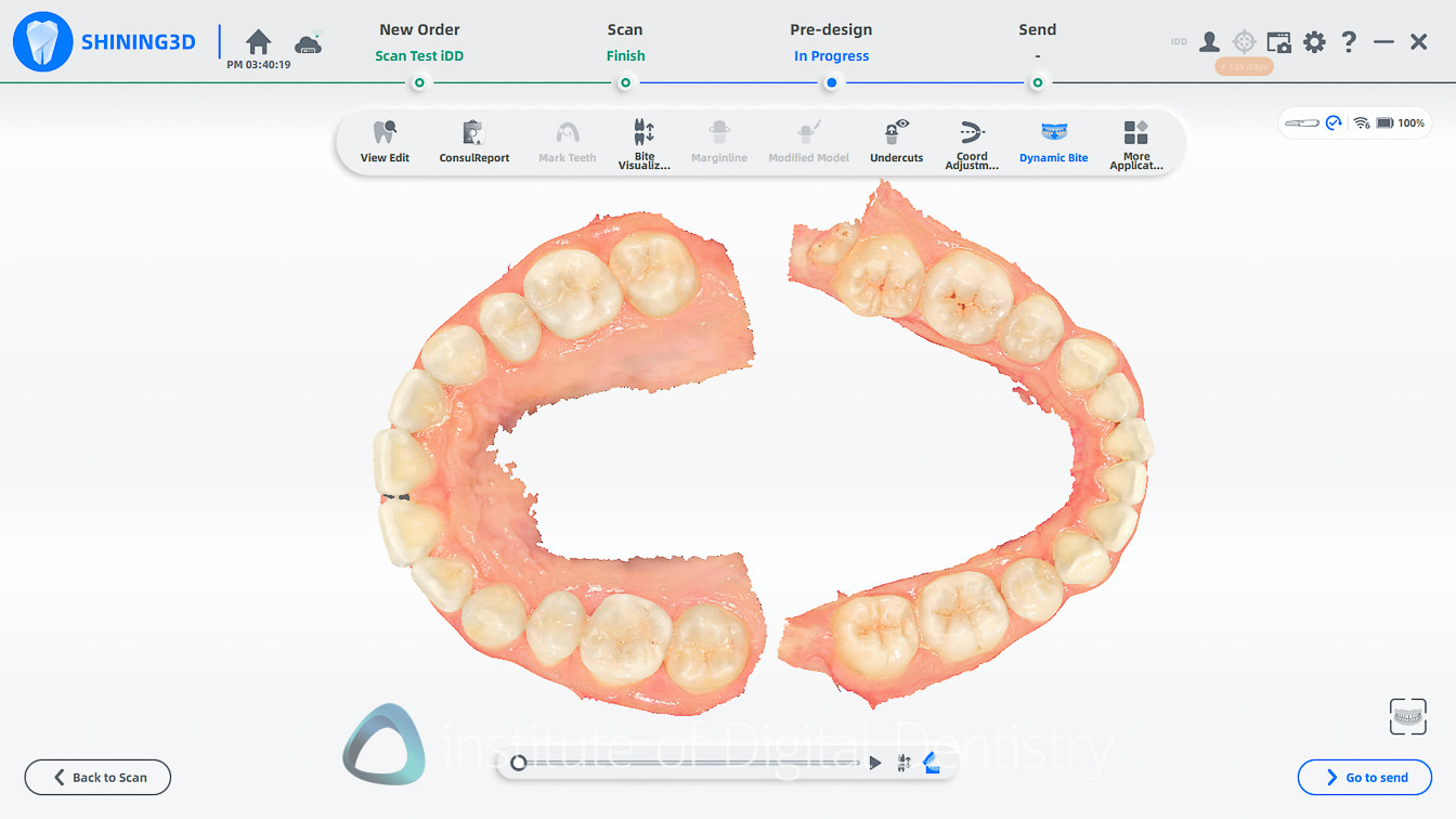 Shining 3D Aoralscan Elite Wireless Intraoral Scanner Review - iDD