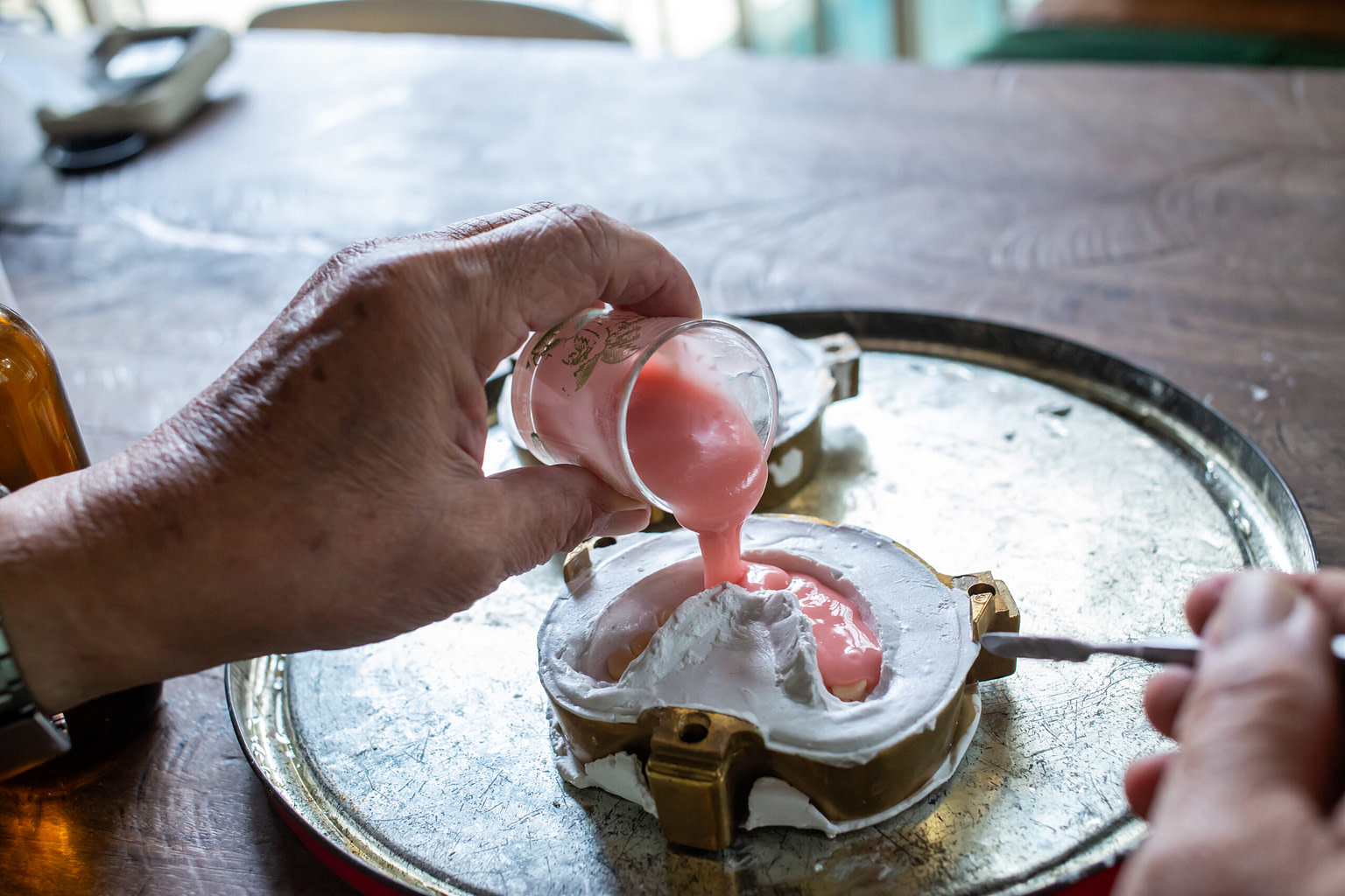 The Evolution of Dentures: From Traditional to Digital - Institute of ...