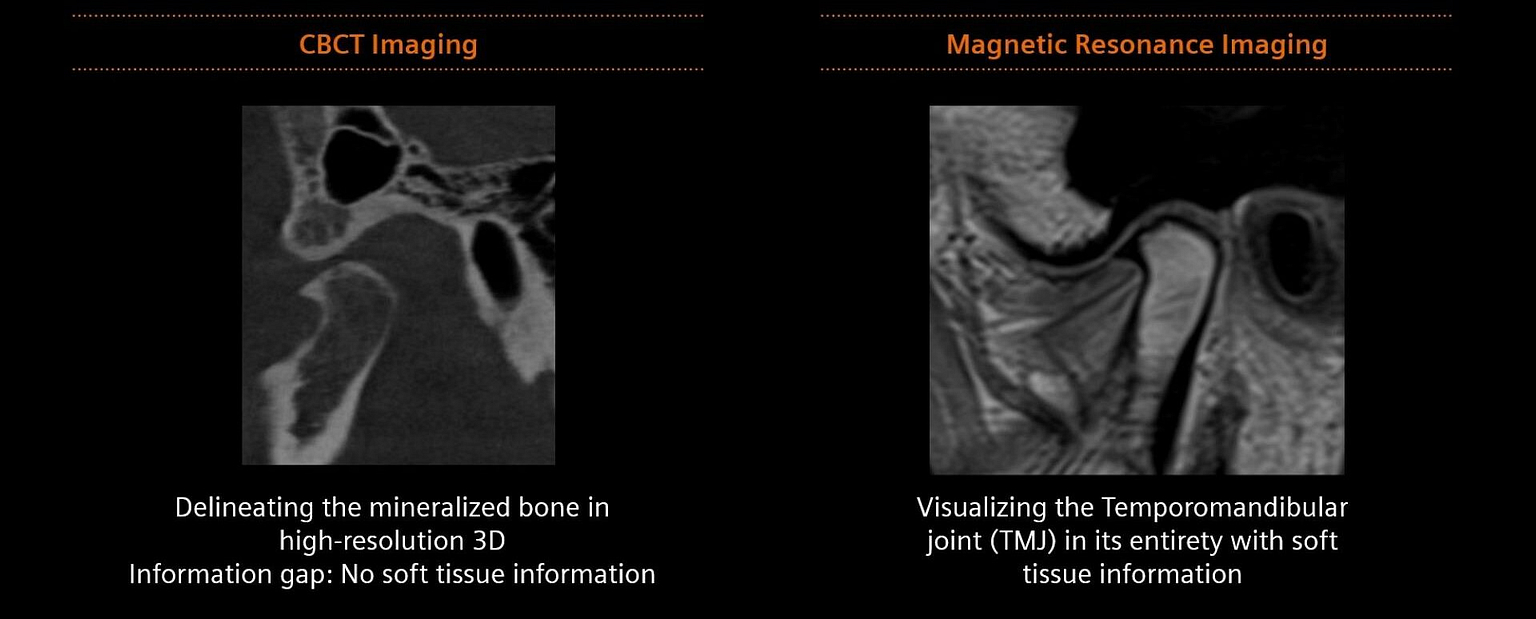 Dentsply Sirona's New Dental MRI Collaboration