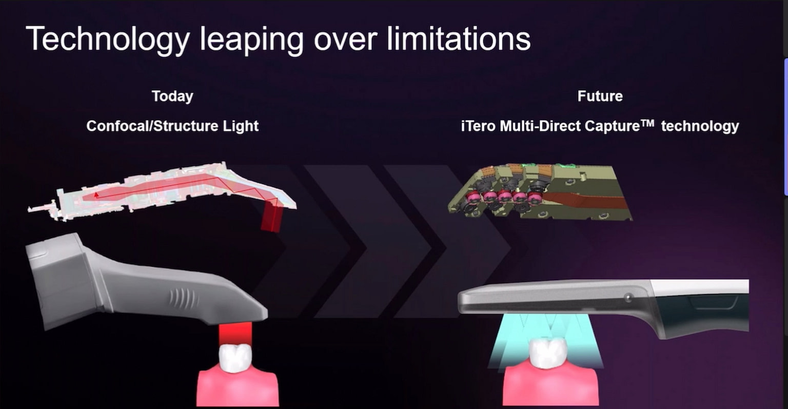 iTero Lumina Released! All details about this new intraoral scanner