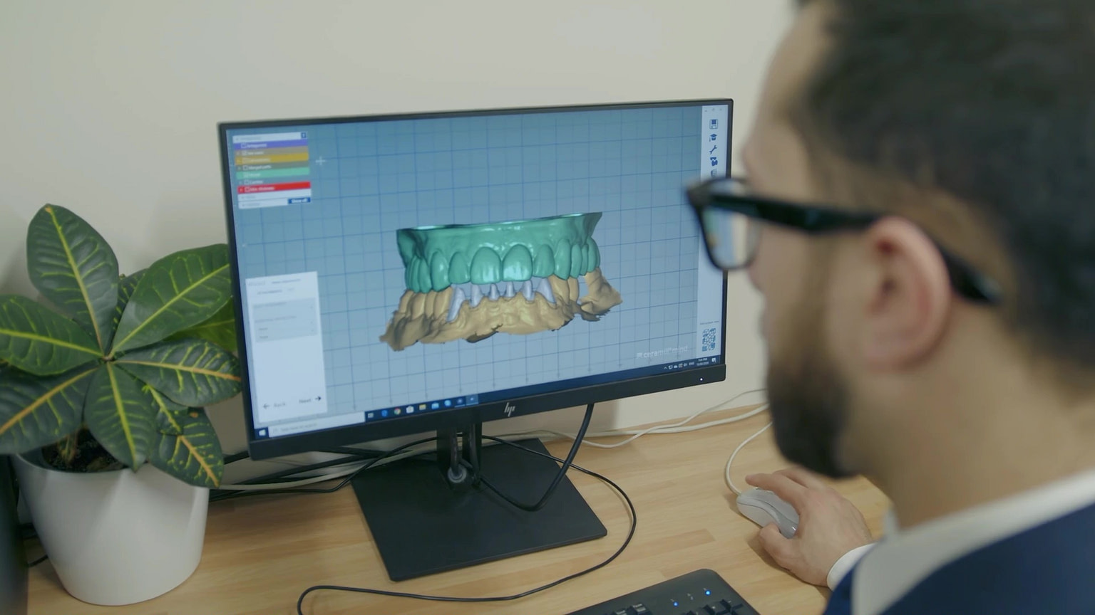 Learn Dental CAD | Institute Of Digital Dentistry