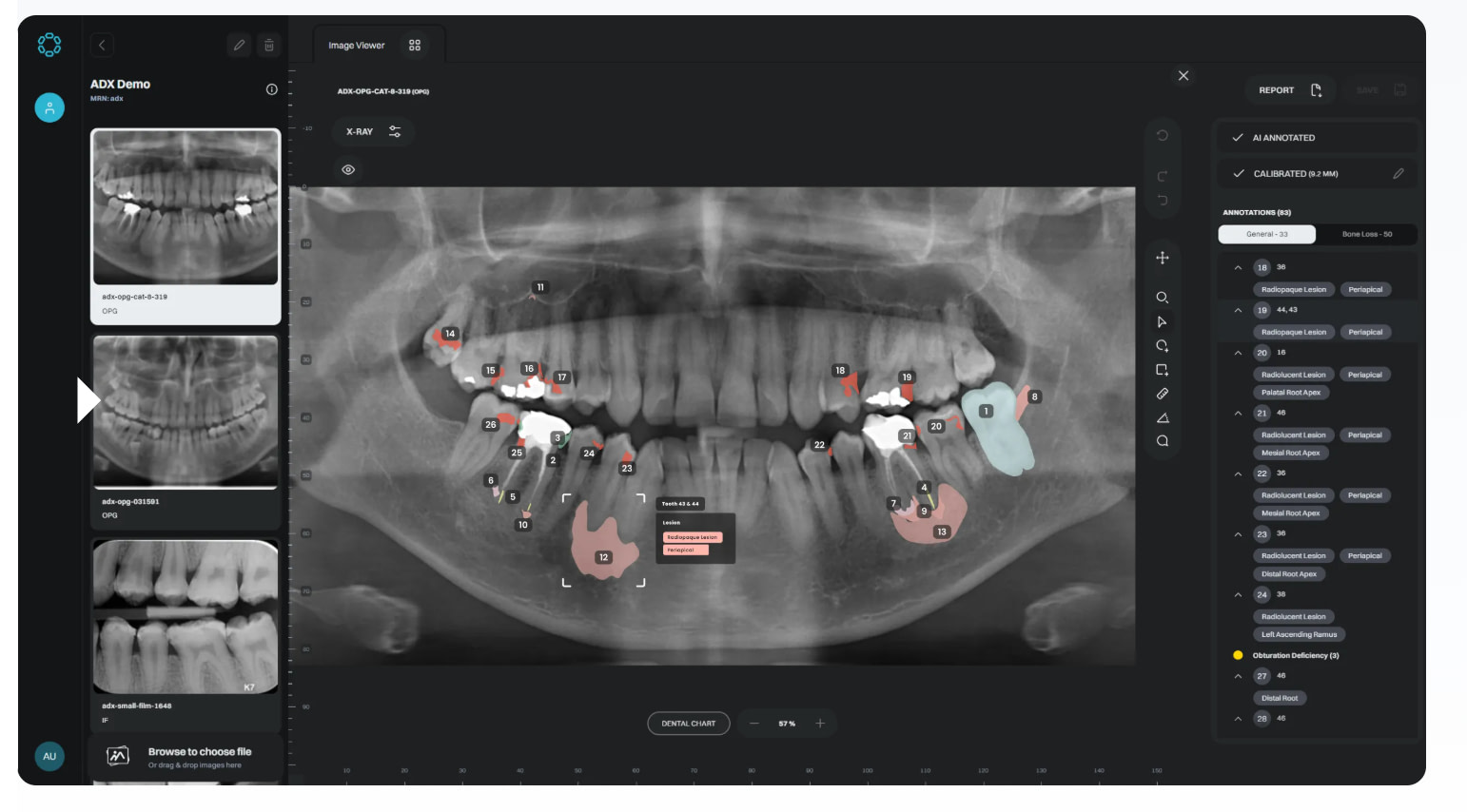 Cephalometric Analysis Meets AI - Eyes of AI Overview - Institute of ...