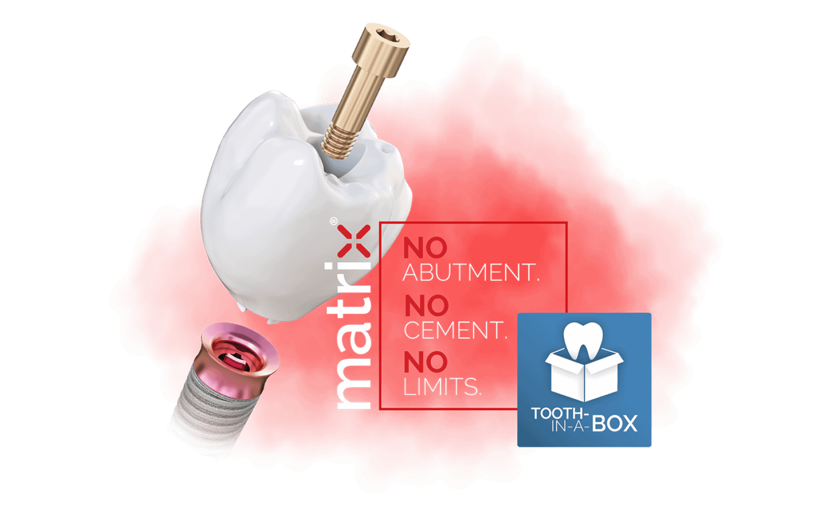 Implant Abutments vs Direct to Fixture: TRI’s New Approach