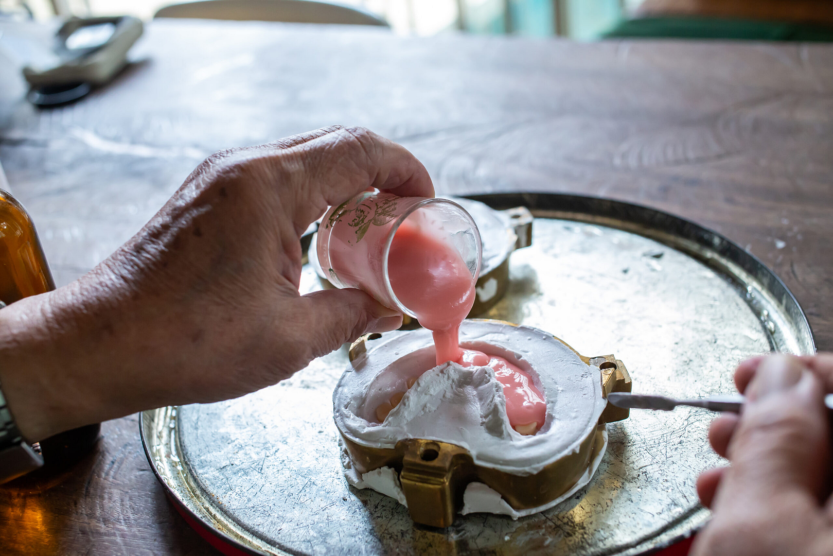 The Evolution of Dentures: From Traditional to Digital - Institute of ...