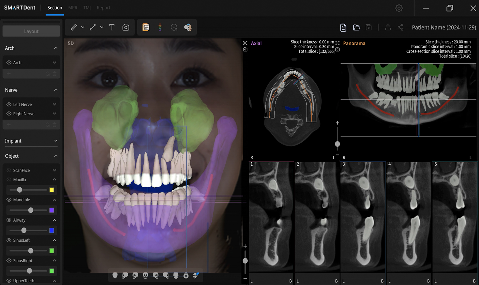 S03 E02 Ray's 5D Solution: The Future of Digital Dentistry Integration ...
