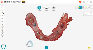 DEXIS IS 3800 Wireless Intraoral Scanner Review by iDD