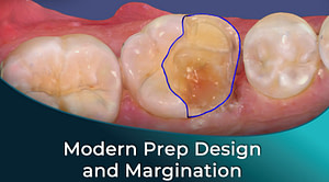 Learn Dental CAD | Institute Of Digital Dentistry