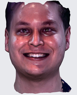 RAYFace Review – Is it the Best 3D Facial Scanner for Dentists?