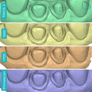 We Compared Older Generation Intraoral Scanners