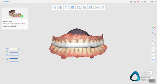 Medit i600 Review - Is this low-cost intraoral scanner worth buying?