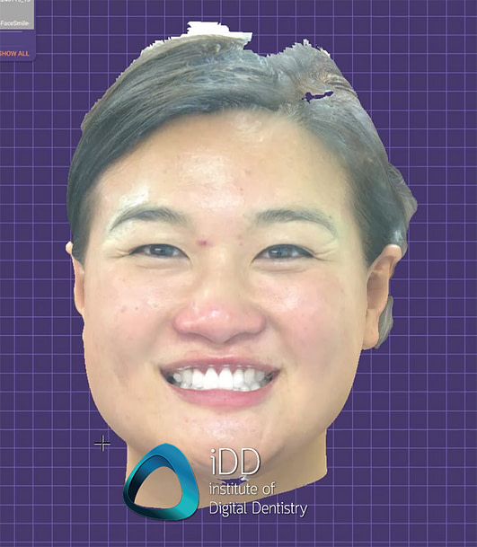 Face Scanners in Dentistry - Handheld, Desktop or iPhone App?