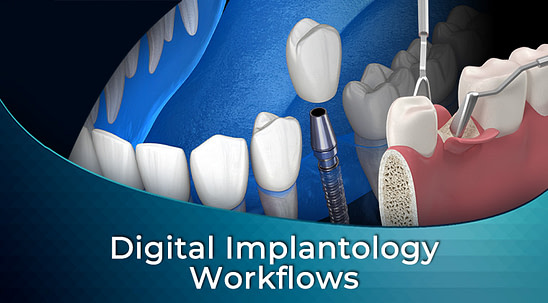 Digital Implantology Online Course Bundle - Learn Digital Dentistry